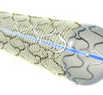 Positive Trial Data For MGuard™Stent With Embolic Protection ...