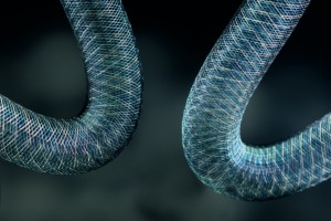 UK NICE Supports Use Of Pipeline® Device For Treating Patients With ...