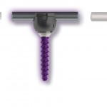 K2M Debuts MESA® Small Stature Pedicle Screw System - Medlatest ...
