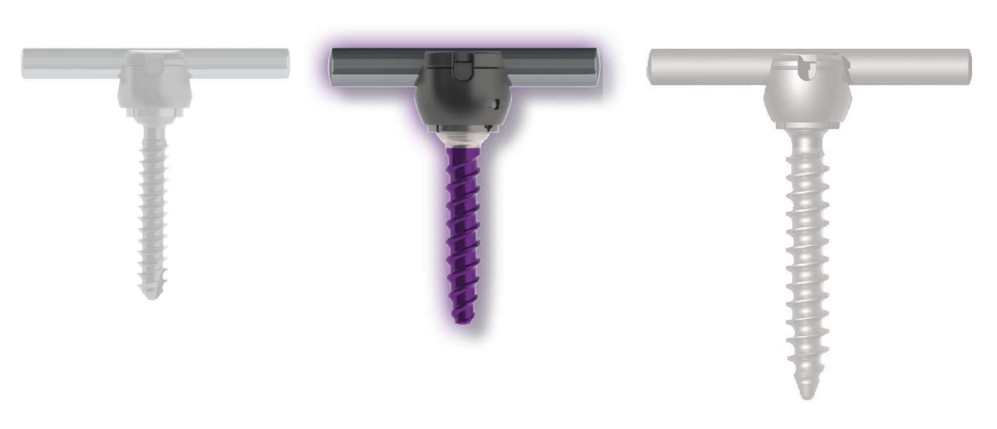 K2M Debuts MESA® Small Stature Pedicle Screw System - Medlatest ...