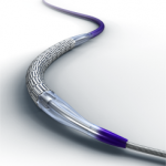 FDA Approves Abbott's Omnilink Elite® Vascular Balloon-Expandable Stent ...