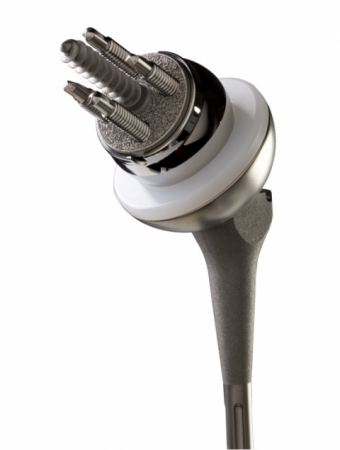 First Patients for DJO's Customised Shoulder System Planning Tool ...