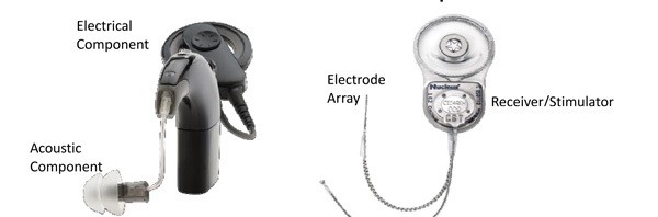 FDA Backs Up Cochlear™Nucleus® Hybrid™Approval - Medlatest - Medical ...