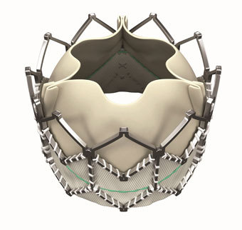 TAVI Pendulum Swings Back Edwards Way as Sapien XT Gets FDA Approval ...